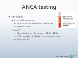Anca vasculitis & anti gbm | PPTX