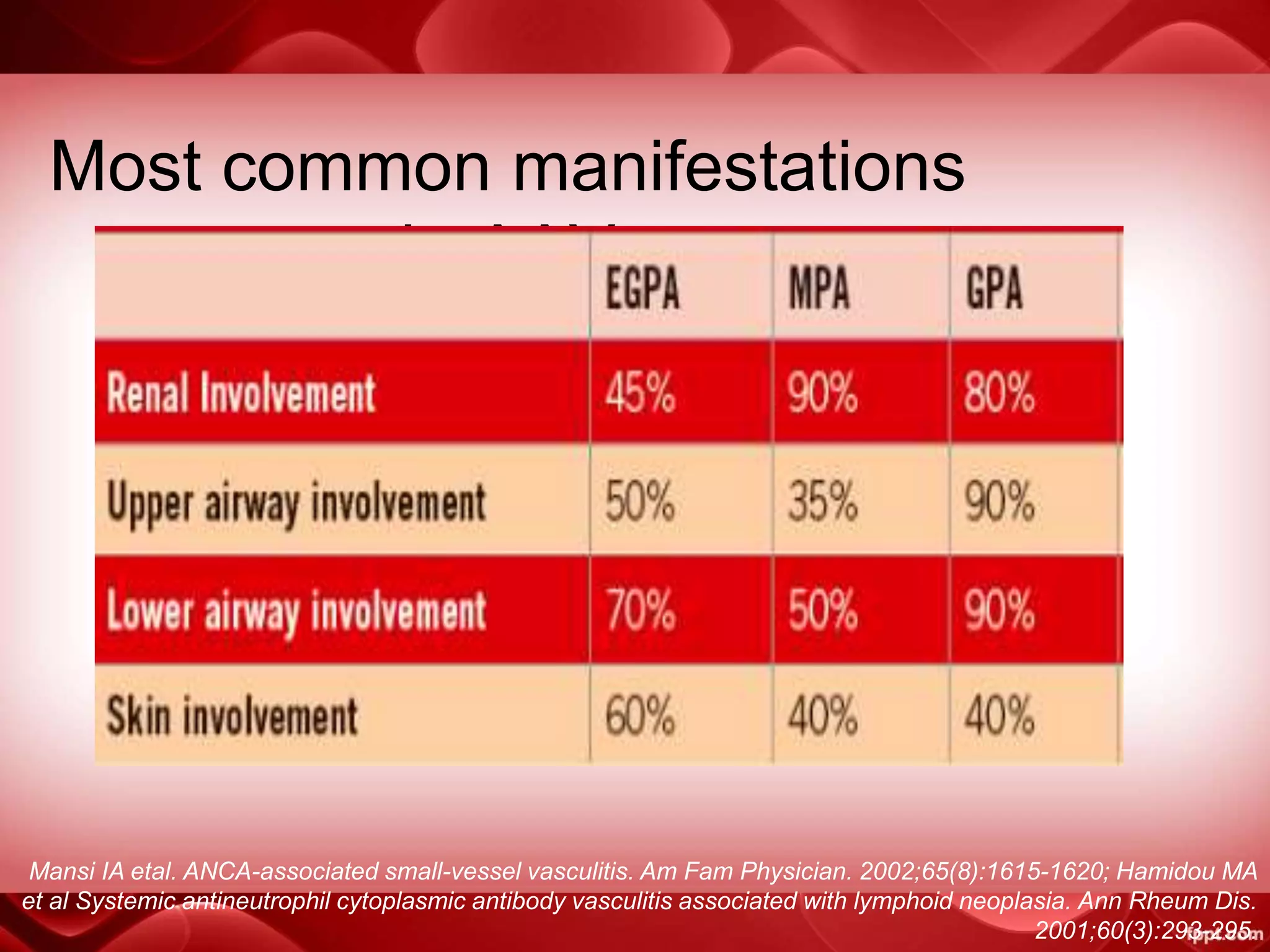 ANCA vasculitis | PPT