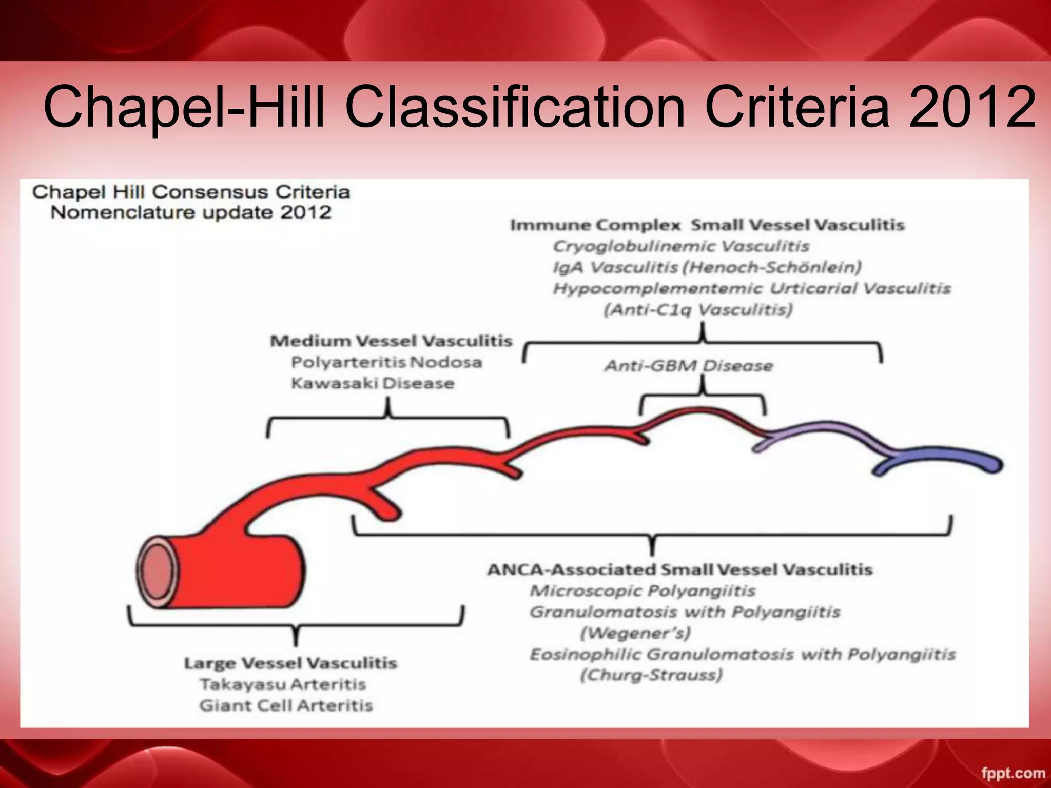 ANCA vasculitis | PPT