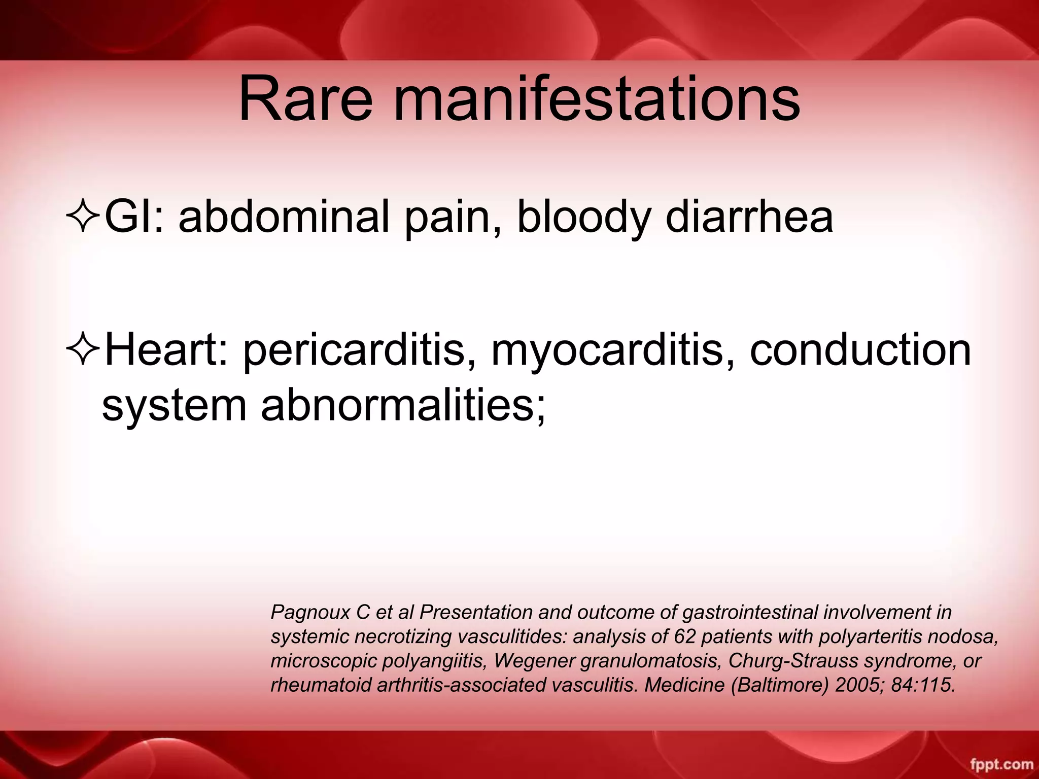 ANCA vasculitis | PPT