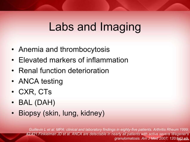 ANCA vasculitis | PPT