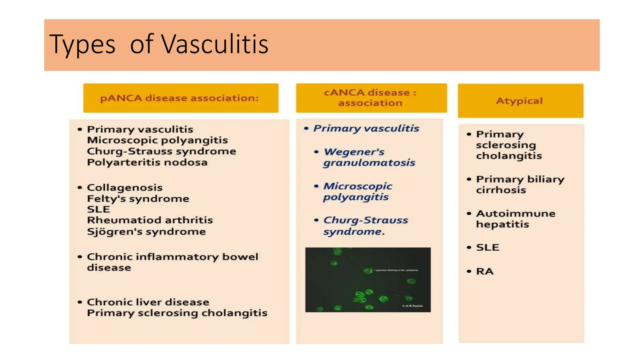 Antineutrophilic cytoplasmic Vasculitis. | PPTX