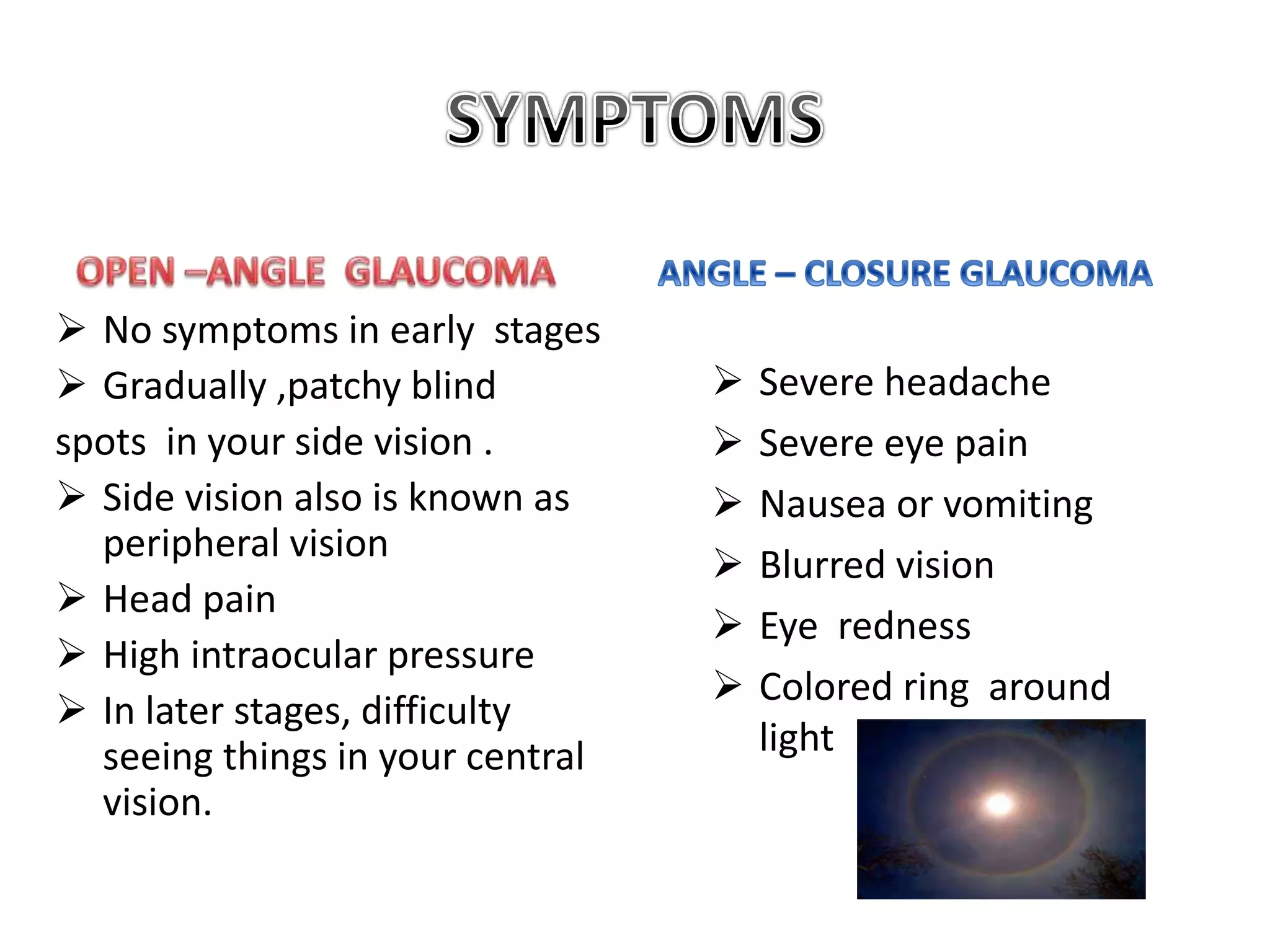 GLAUCOMA | PPTX