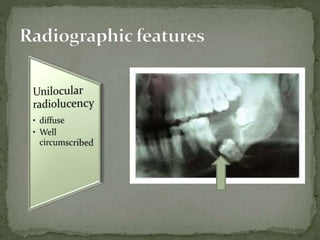Pindborg tumor by Anchal Mehra | PPTX