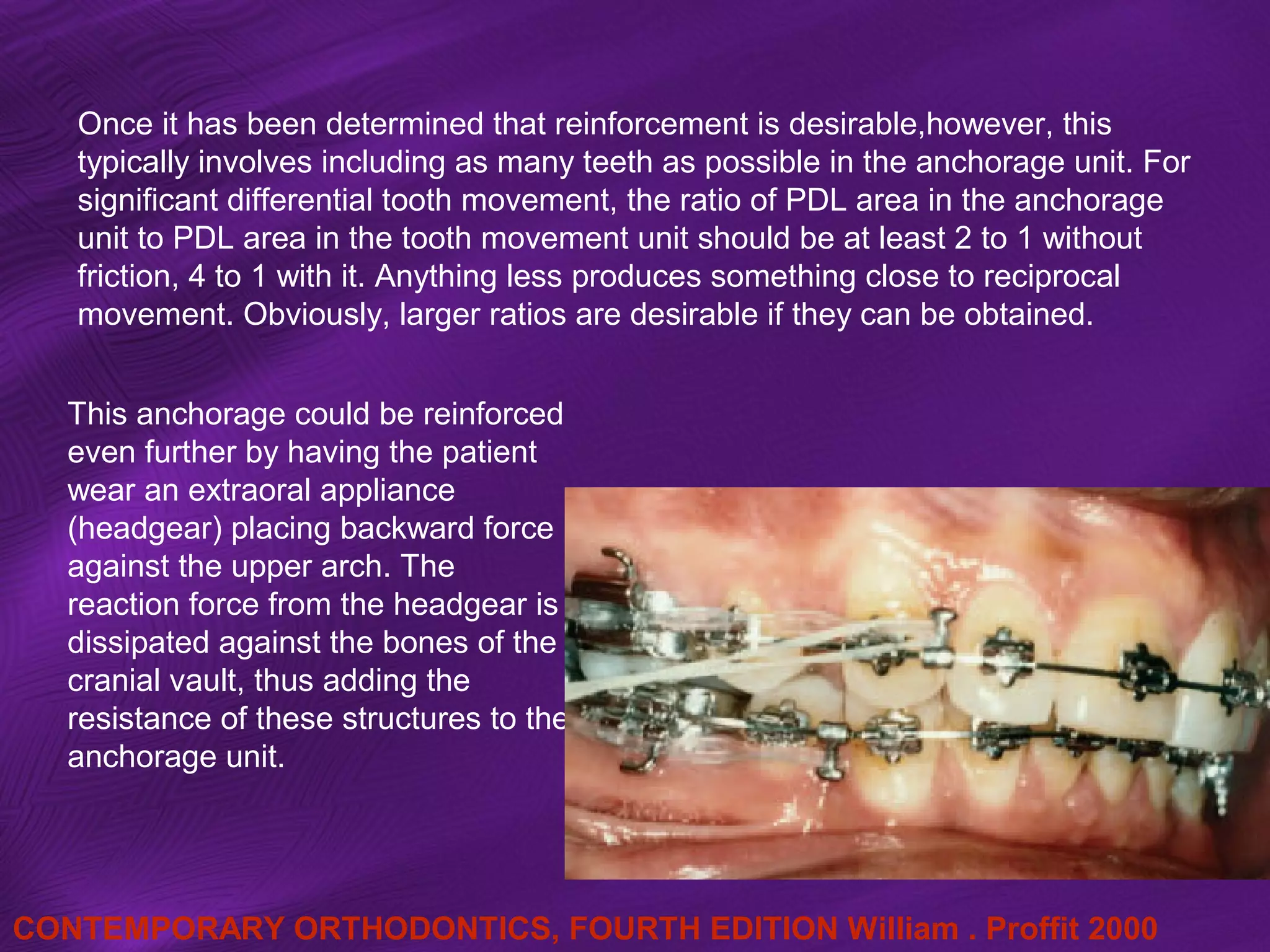 Anchorage in orthodontics | PPT