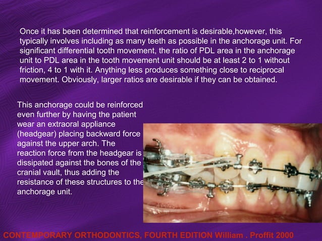 Anchorage in orthodontics | PPT