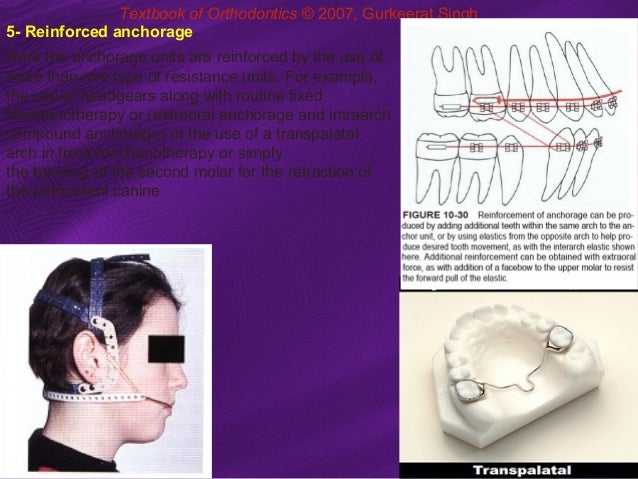Anchorage in orthodontics