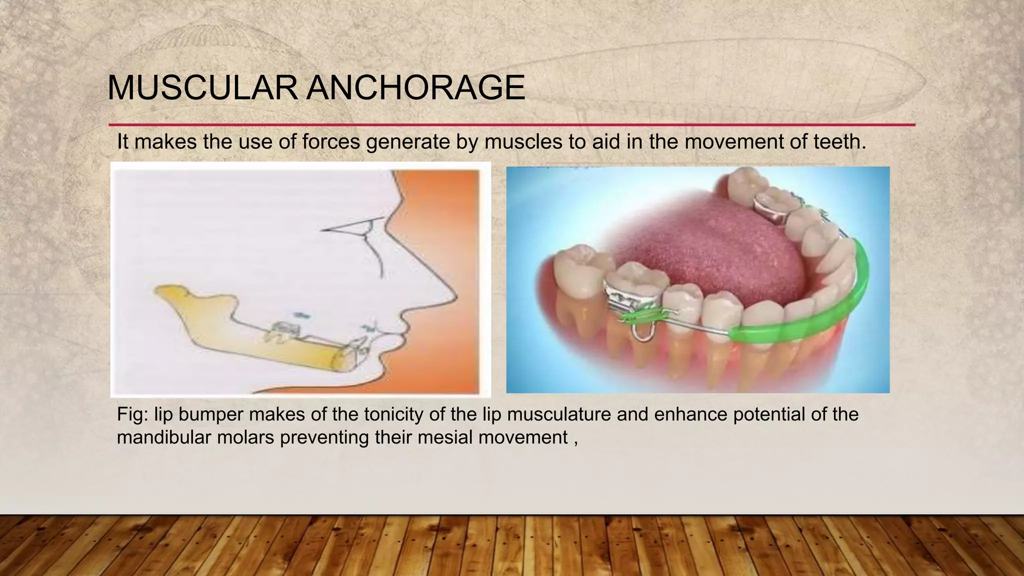 Anchorage in orthodontics | PPTX