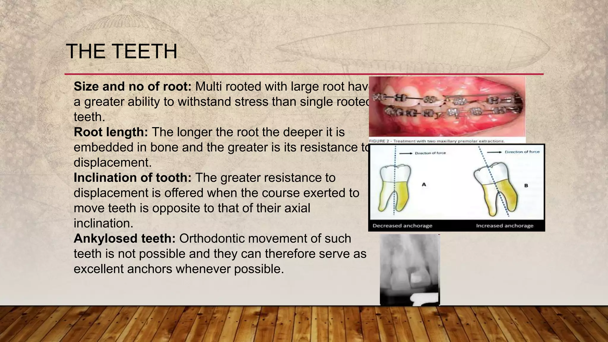 Anchorage in orthodontics | PPTX