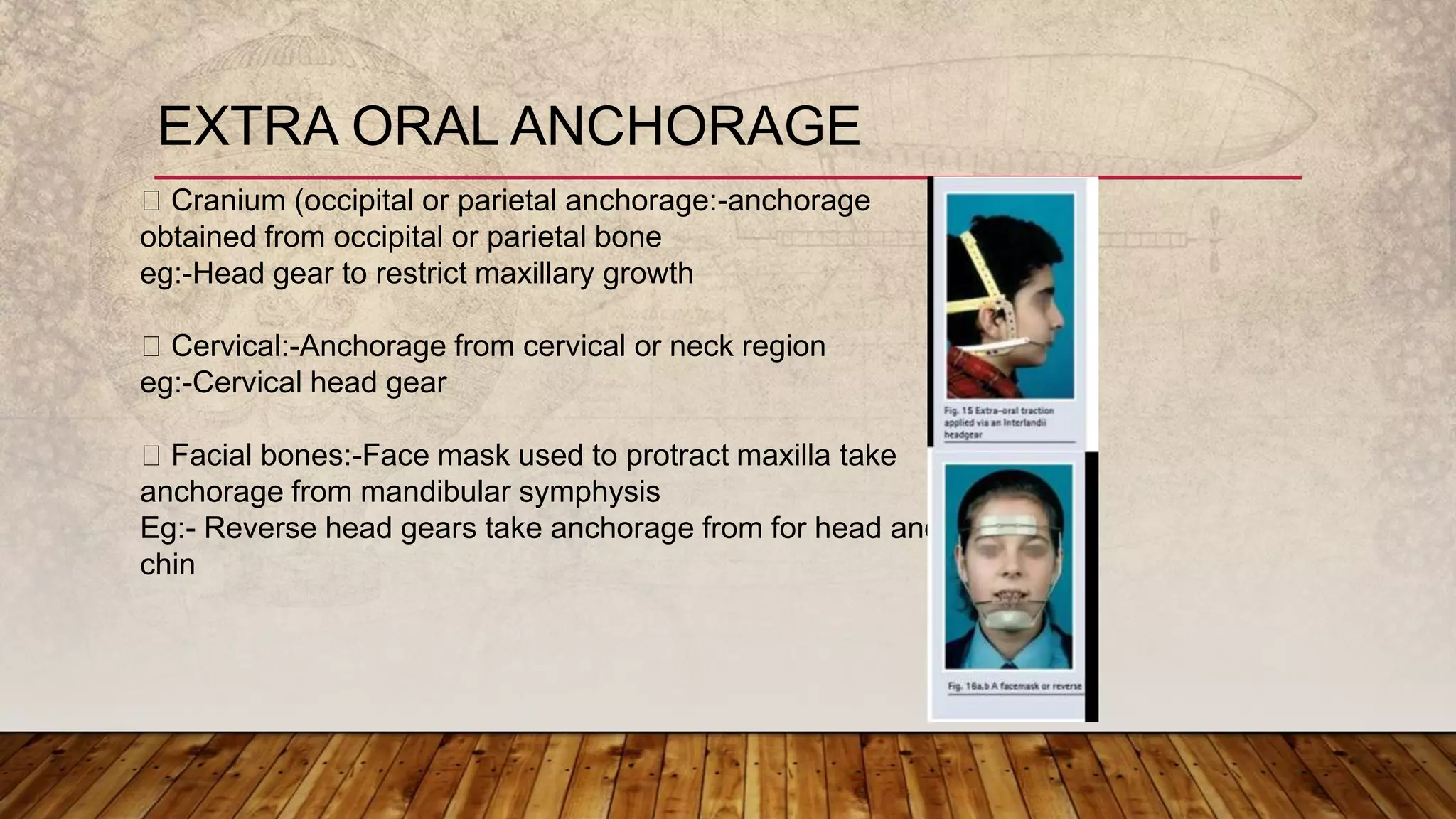 Anchorage in orthodontics | PPTX
