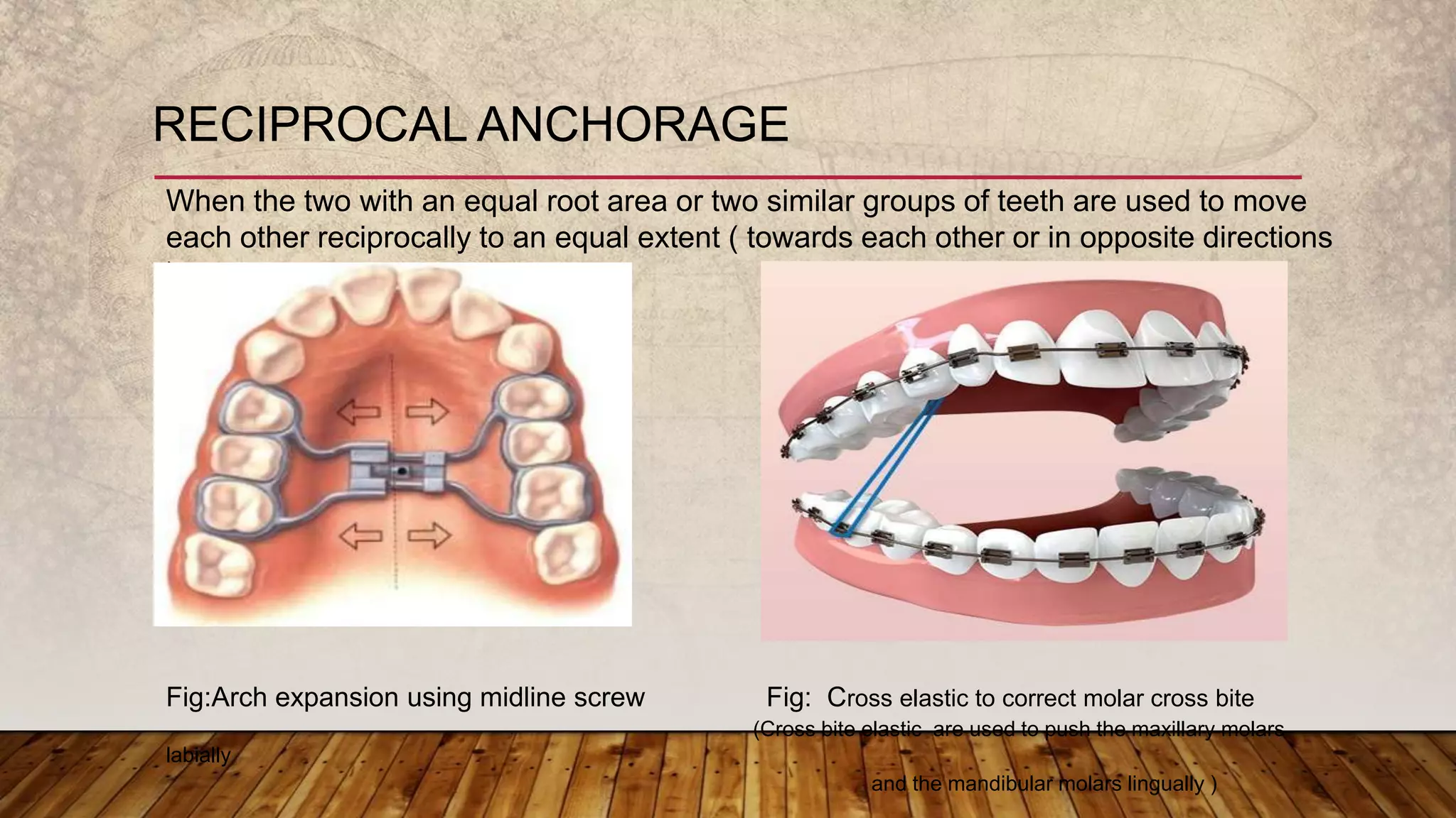 Anchorage in orthodontics | PPTX