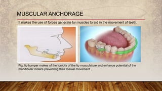 Anchorage in orthodontics | PPTX