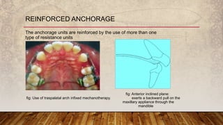 Anchorage in orthodontics | PPTX