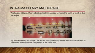 Anchorage in orthodontics | PPTX
