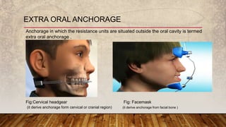 Anchorage in orthodontics | PPTX