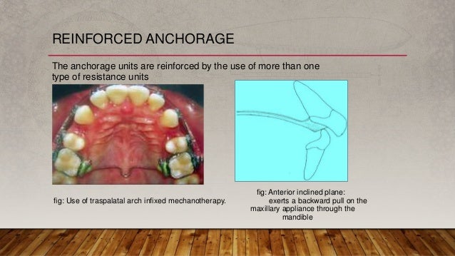 Anchorage in orthodontics