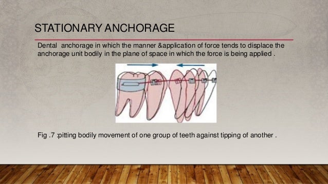 Anchorage in orthodontics