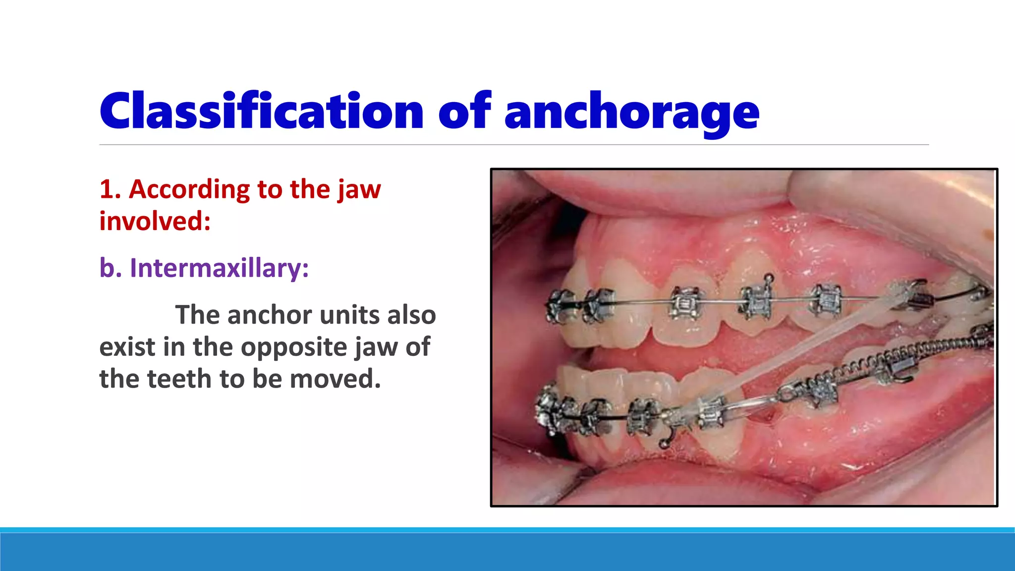 Anchorage in Orthodontic | PPTX