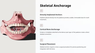 Anchorage-in-Orthodontics .pptx