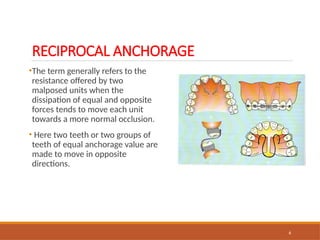 Comprehensive Overview of Orthodontic Anchorage: Types, Units, and ...