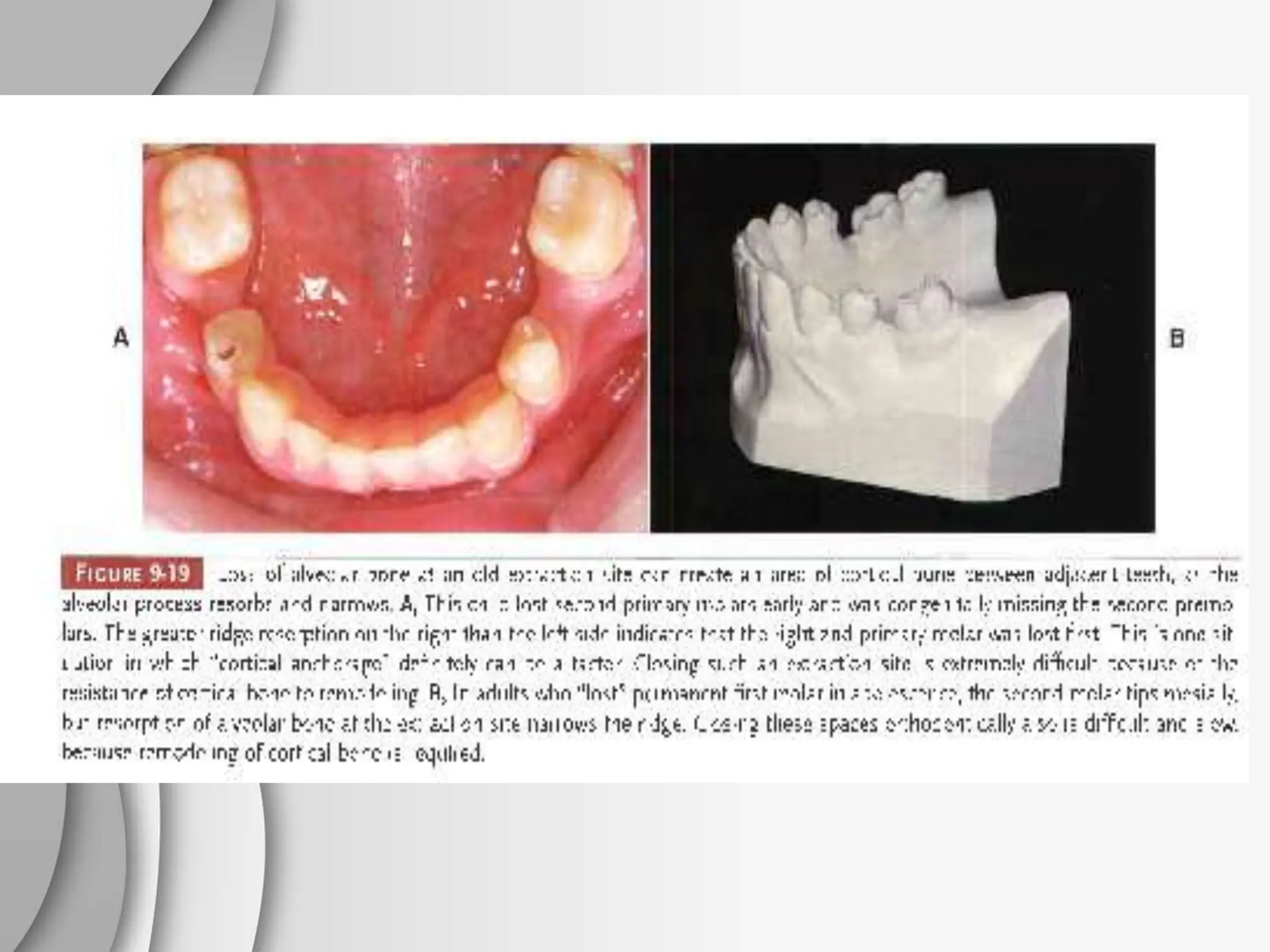 Anchorage and Control Relationship Tooth movement t o Force.pptx