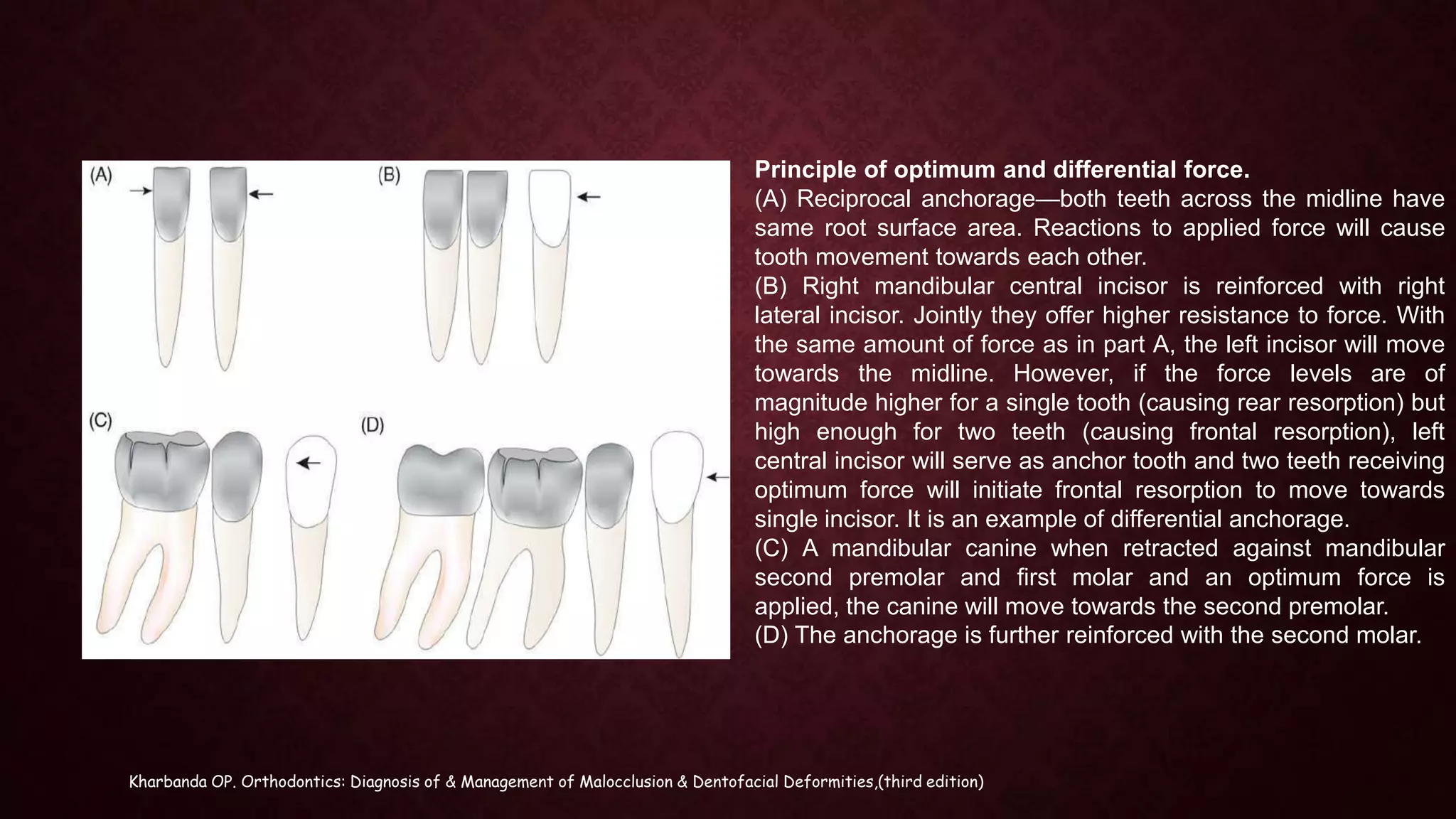 Anchorage and its control | PPTX