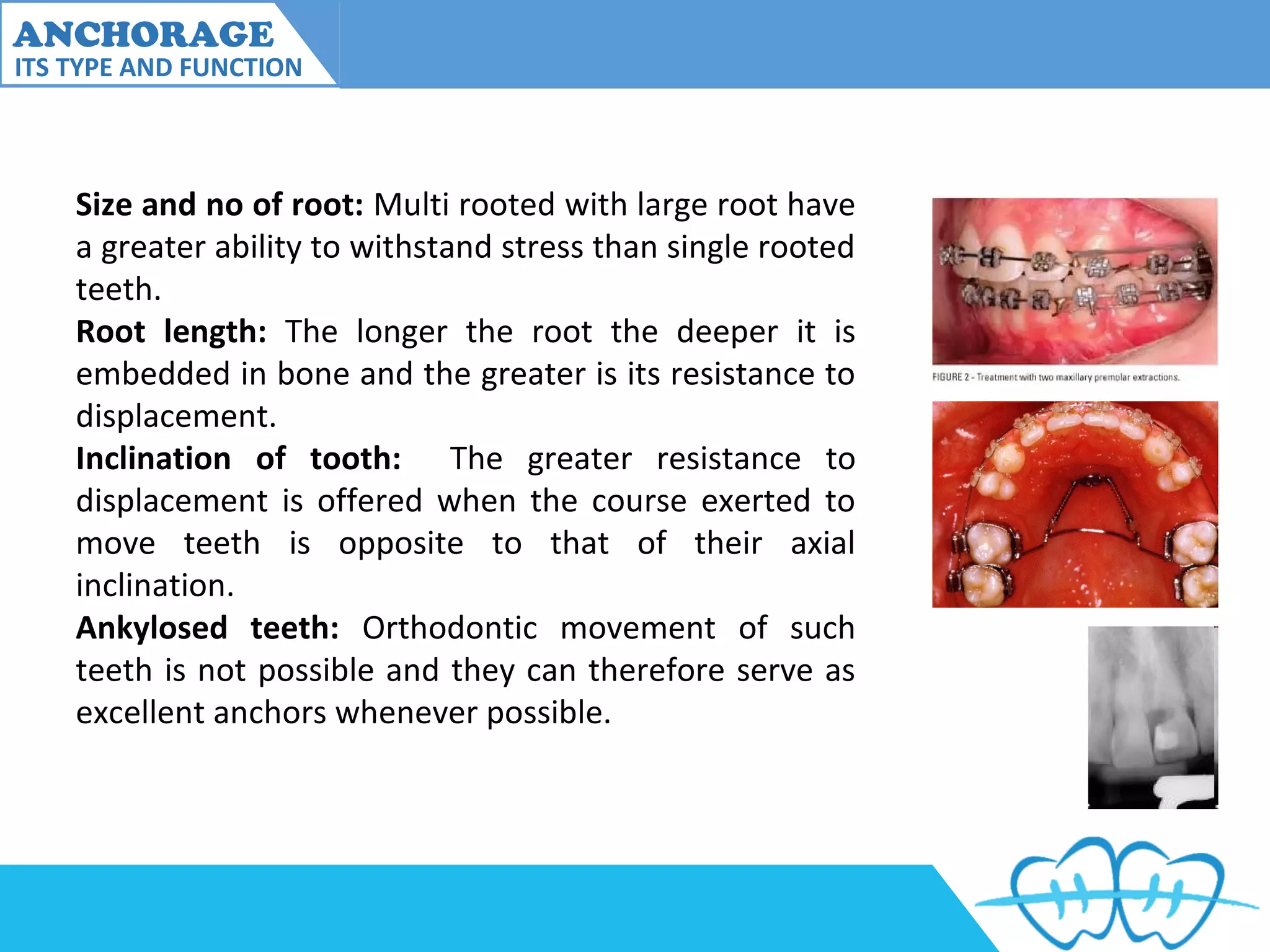 Anchorage and its type and variations | PPT