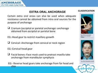 Anchorage and its type and variations | PPT