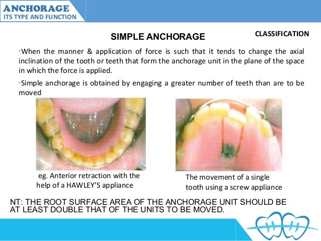 Anchorage and its type and variations