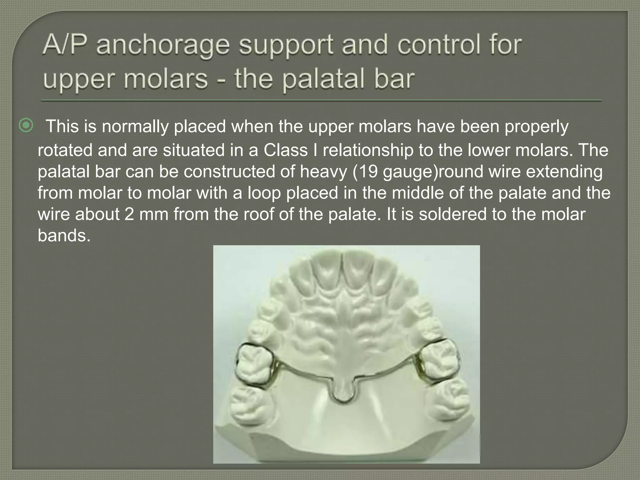 Anchorage control during tooth leveling and aligning | PPTX