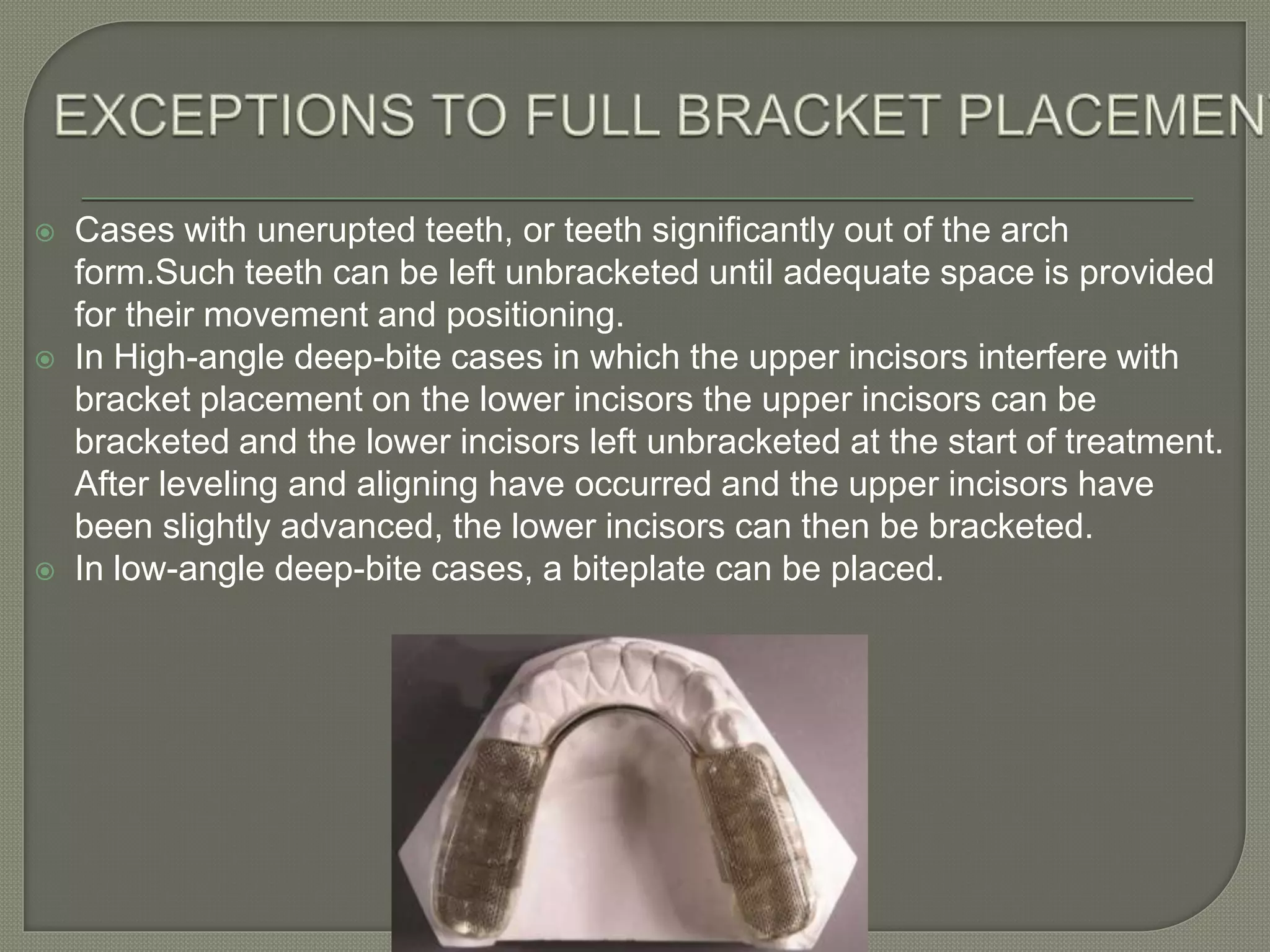 Anchorage control during tooth leveling and aligning | PPTX