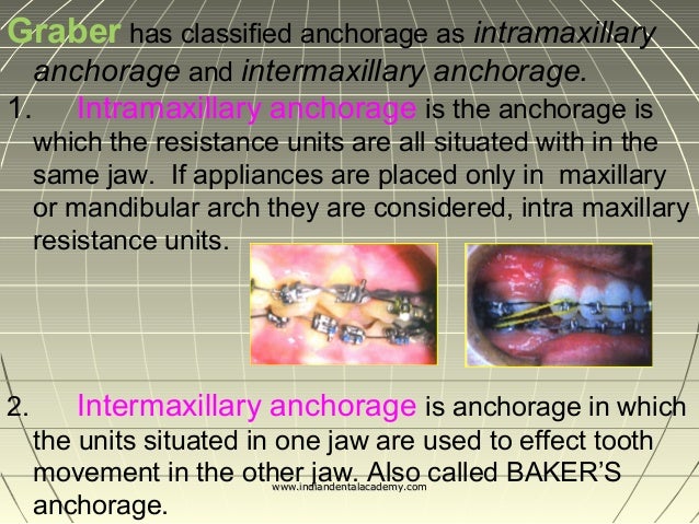 Anchorage in orthodontics /certified fixed orthodontic courses by Ind…