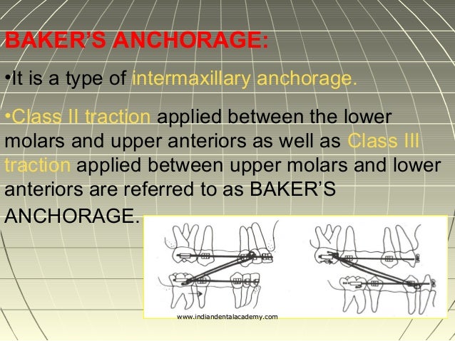 Anchorage in orthodontics /certified fixed orthodontic courses by Ind…
