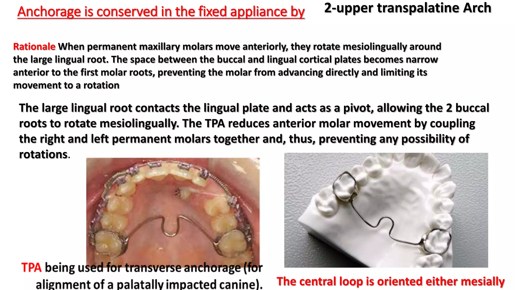 Anchorage for fixed appliance | PPTX