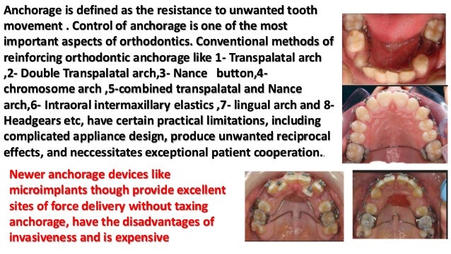 Anchorage for fixed appliance