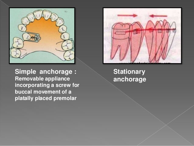 Anchorage in orthodontic treatment