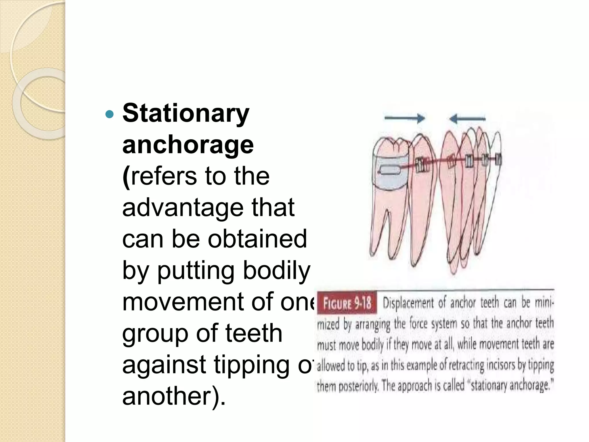 Anchorage in orthodontics- Dr Lubna Abu Alrub | PPTX