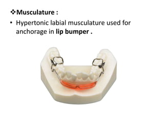 Anchorage in orthodontics | PPTX