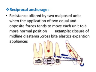 Anchorage in orthodontics | PPTX