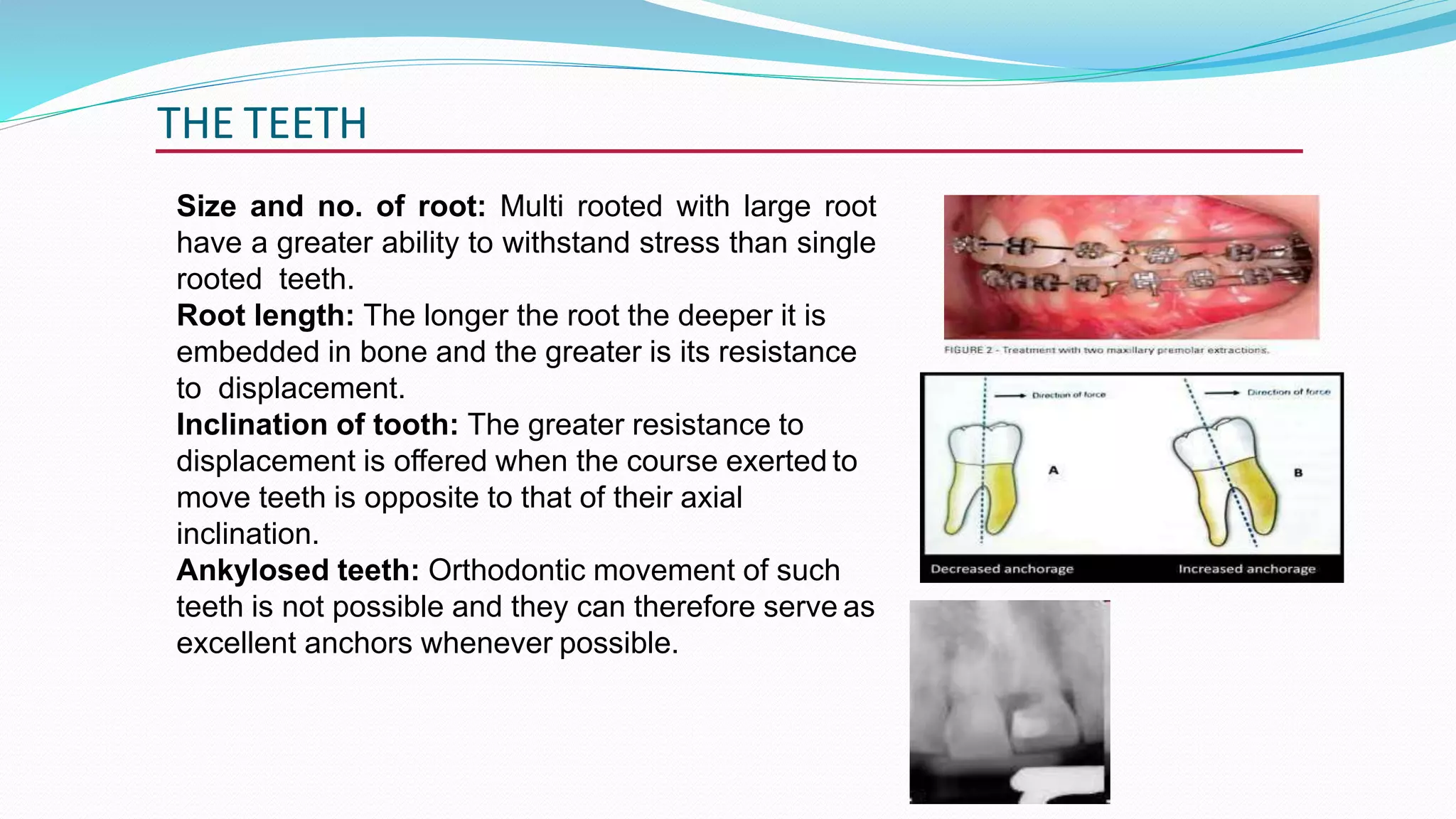 Anchorage in orthodontics | PPTX