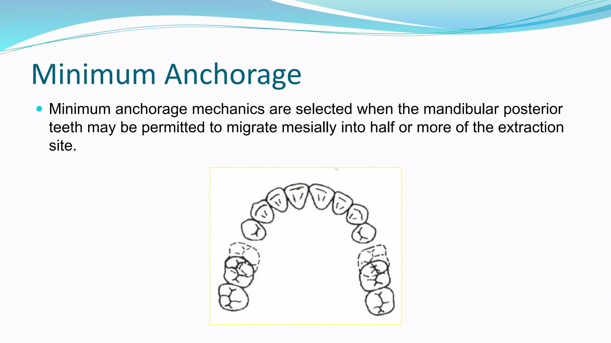Anchorage in orthodontics | PPTX