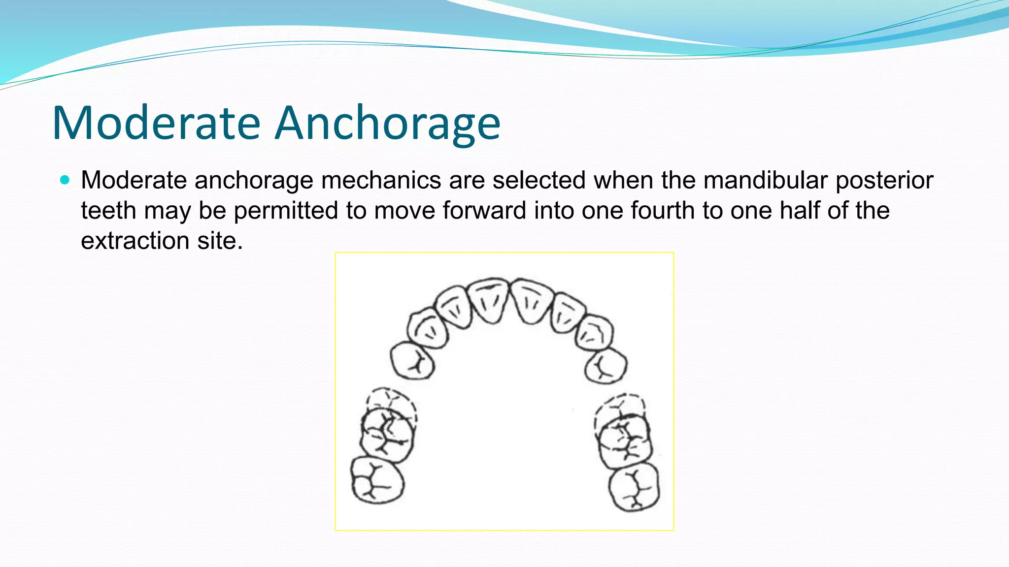 Anchorage in orthodontics | PPTX
