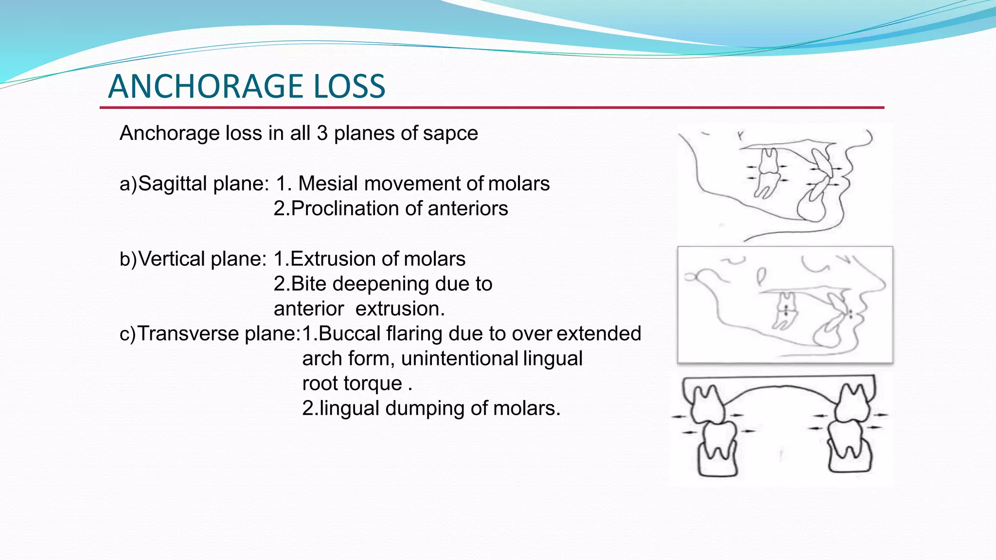 Anchorage in orthodontics | PPTX