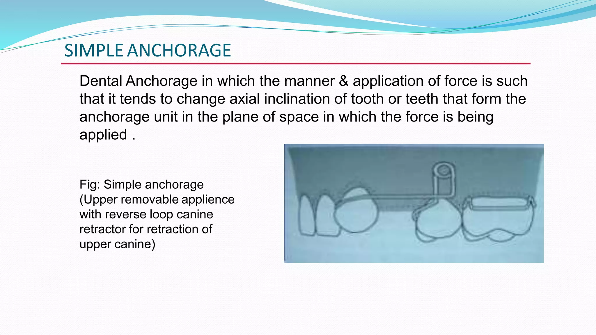Anchorage in orthodontics | PPTX