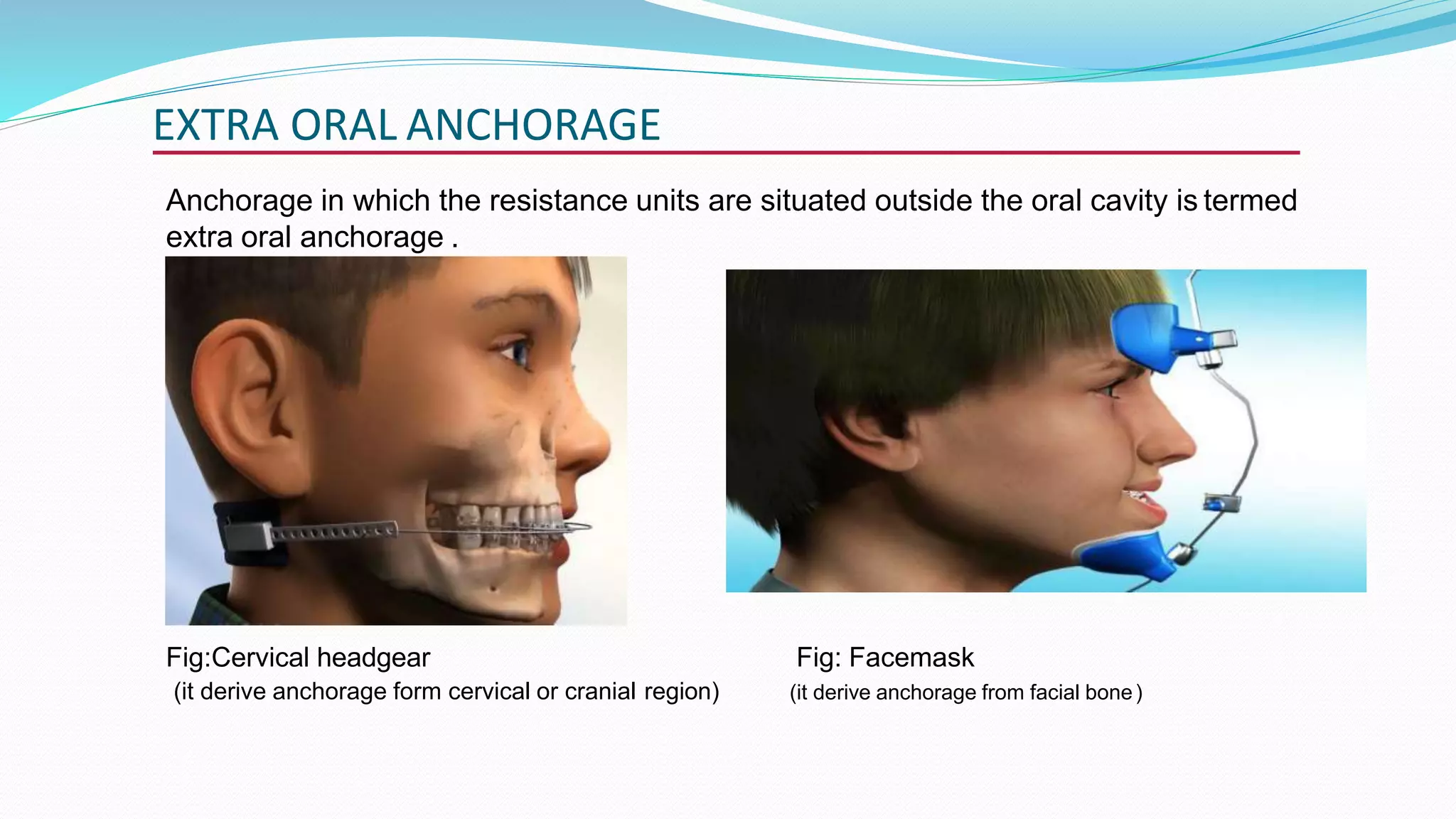 Anchorage in orthodontics | PPTX