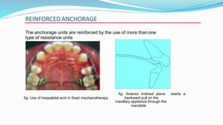 Anchorage in orthodontics | PPTX