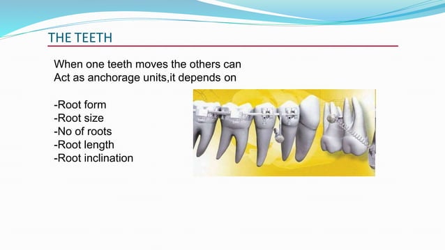 Anchorage in orthodontics | PPTX
