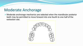 Anchorage in orthodontics | PPTX