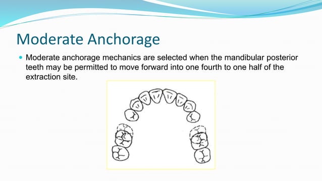 Anchorage in orthodontics | PPTX