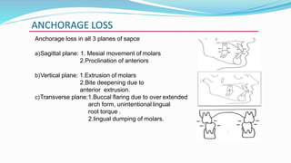 Anchorage in orthodontics | PPTX